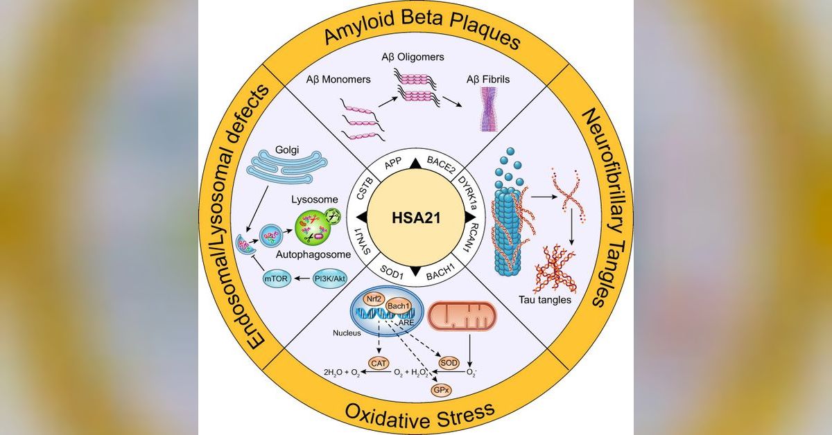Amyloid beta-Peptide and Oxidative Stress in Alzheimer Disease ...
