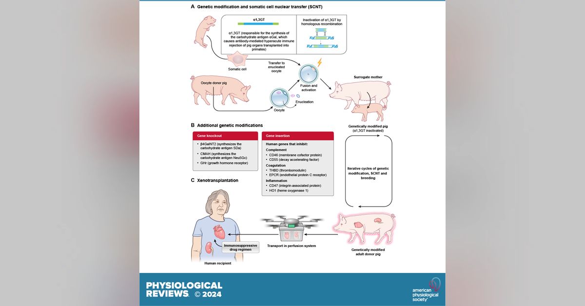 Xenotransplantation from Genetically Modified Pigs to Humans ...