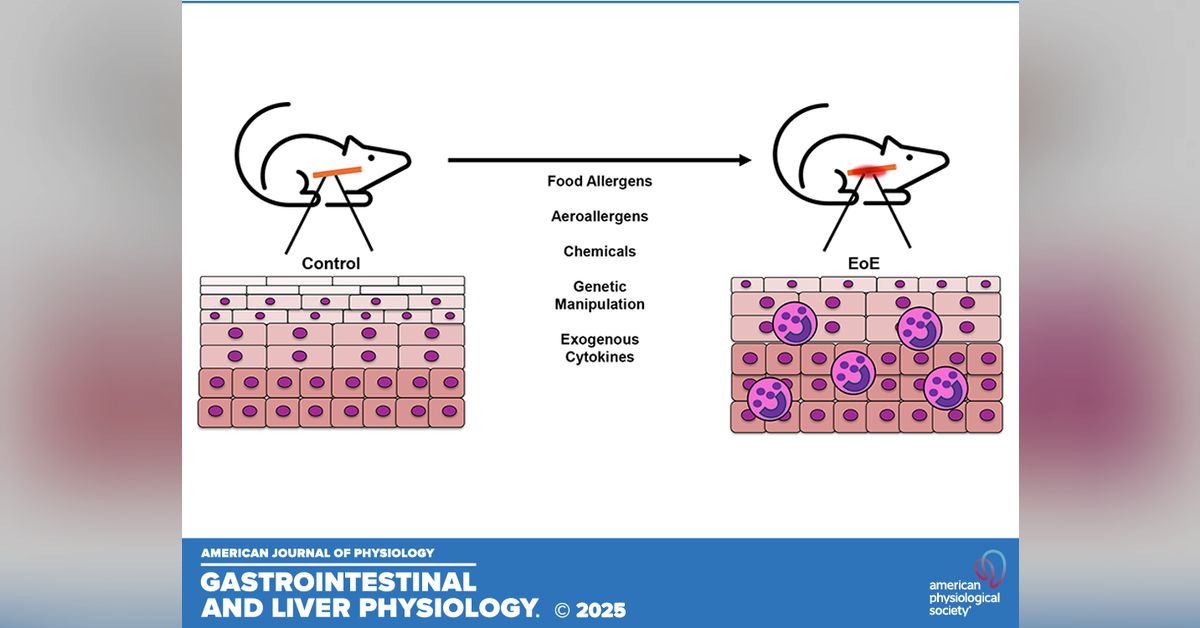 Modeling Eosinophilic Esophagitis: Insights from Mouse Models into ...