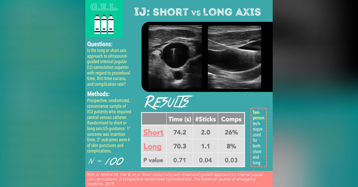Short versus Long for IJ Cannulation | Ultrasound GEL