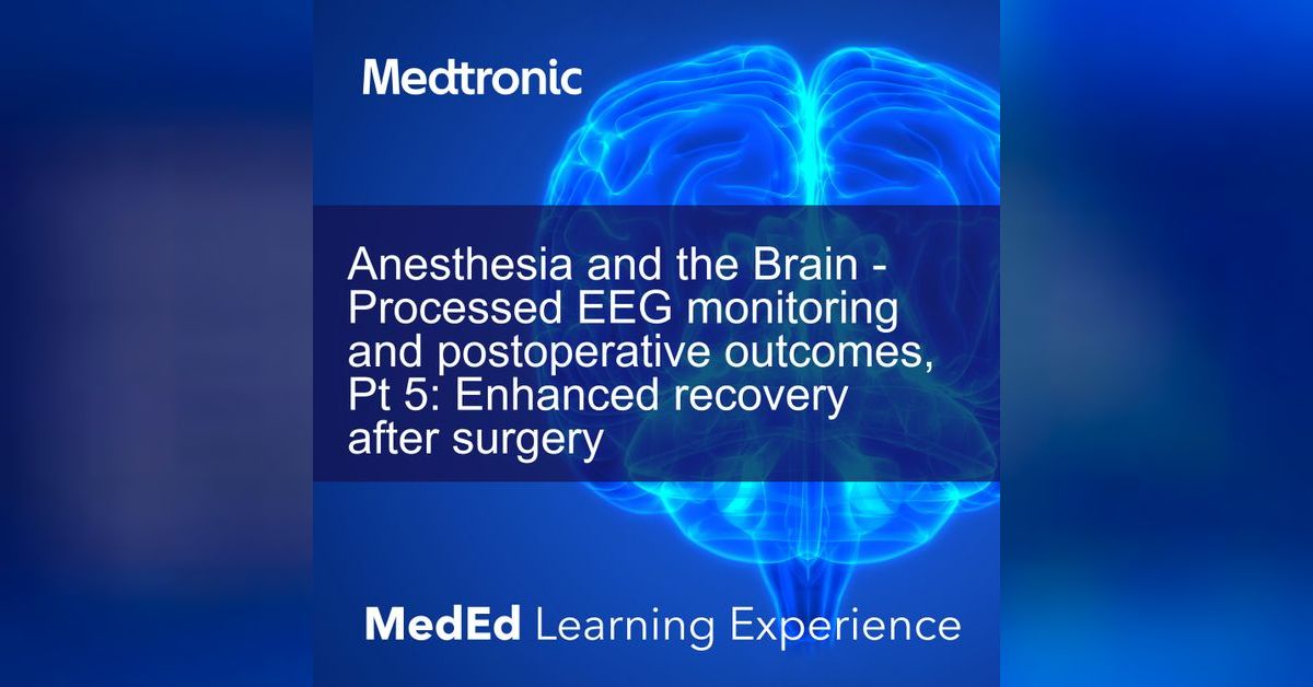 Anesthesia and the Brain - Processed EEG monitoring and postoperative ...