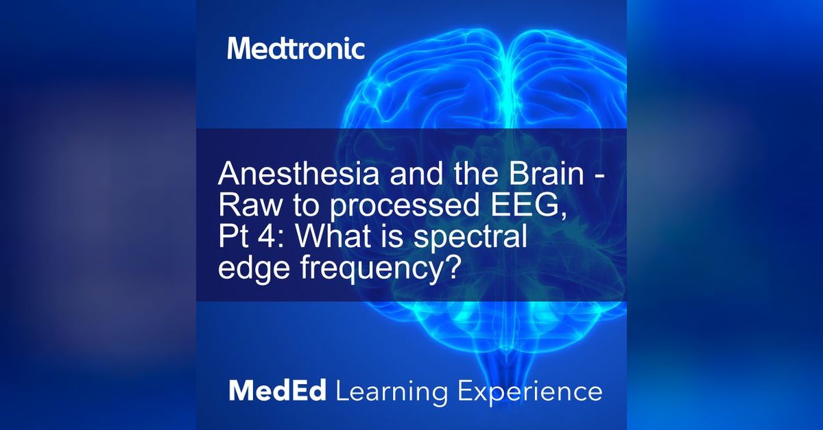 Anesthesia and the Brain - Raw to processed EEG, Pt 4: What is spectral ...