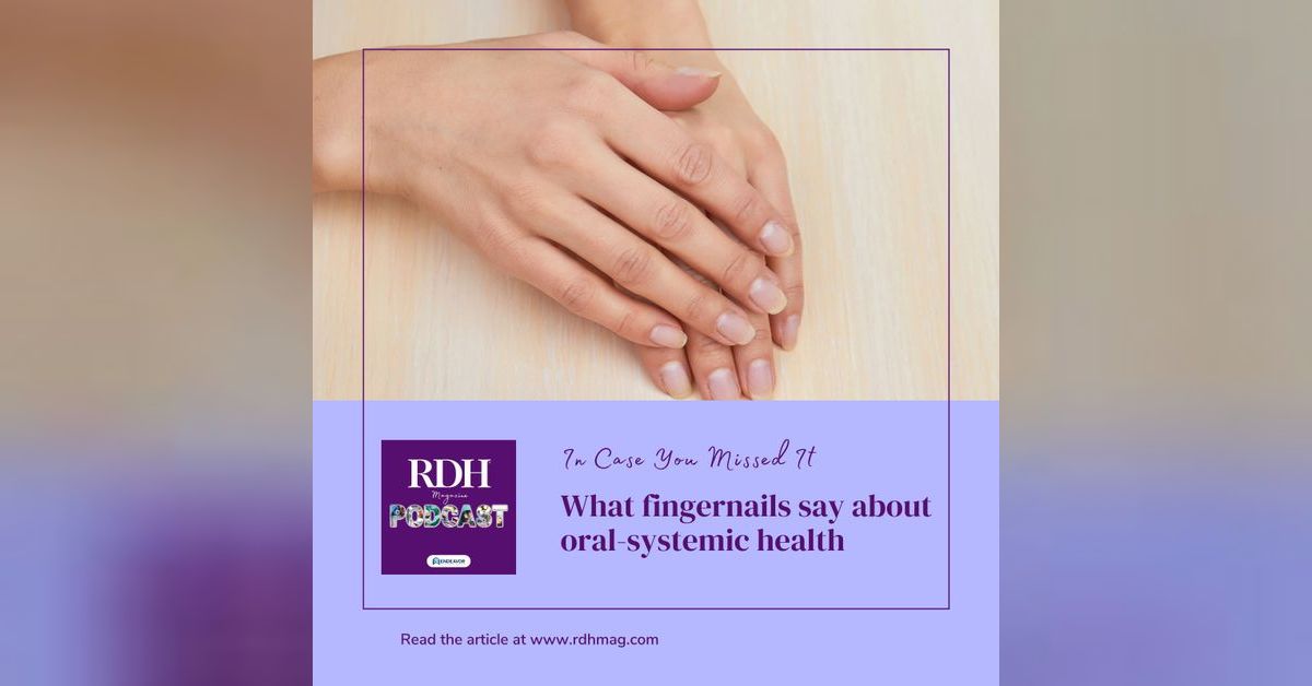 ICYMI: What fingernails say about oral-systemic health | RDH Magazine ...
