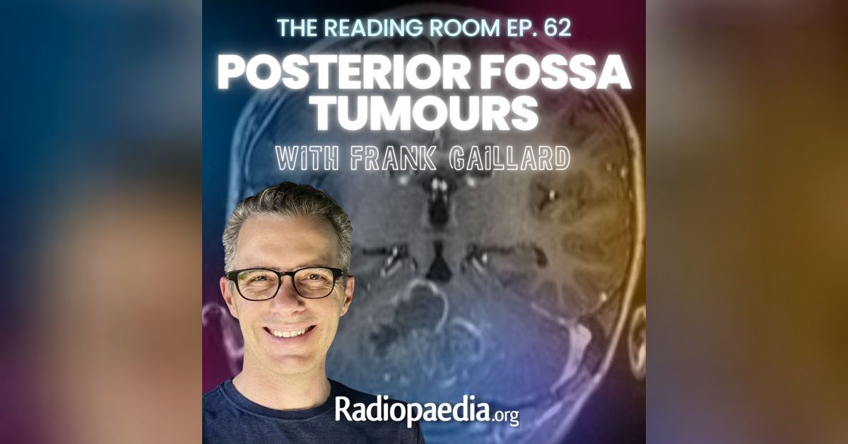 62. Posterior fossa tumours with Frank Gaillard | The Radiopaedia ...