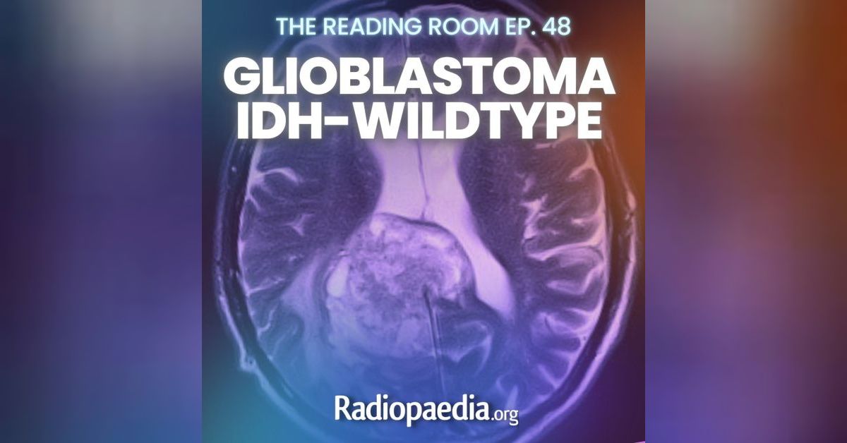 48. Readful! Glioblastoma with Frank Gaillard | The Radiopaedia Reading ...