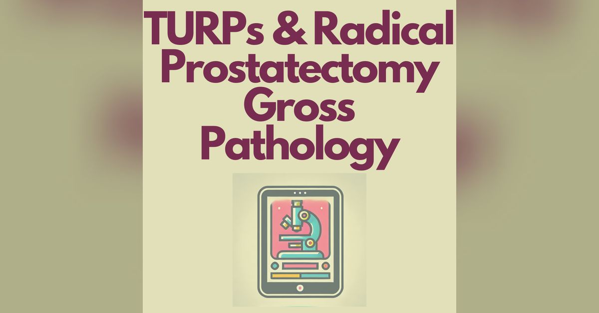 TURPs and Radical Prostatectomy - Prostate Anatomy and Gross Pathology ...