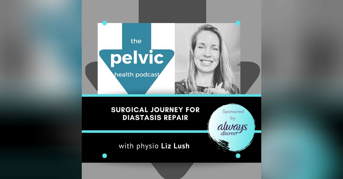 Surgical journey for DRA repair with physiotherapist and patient Liz ...