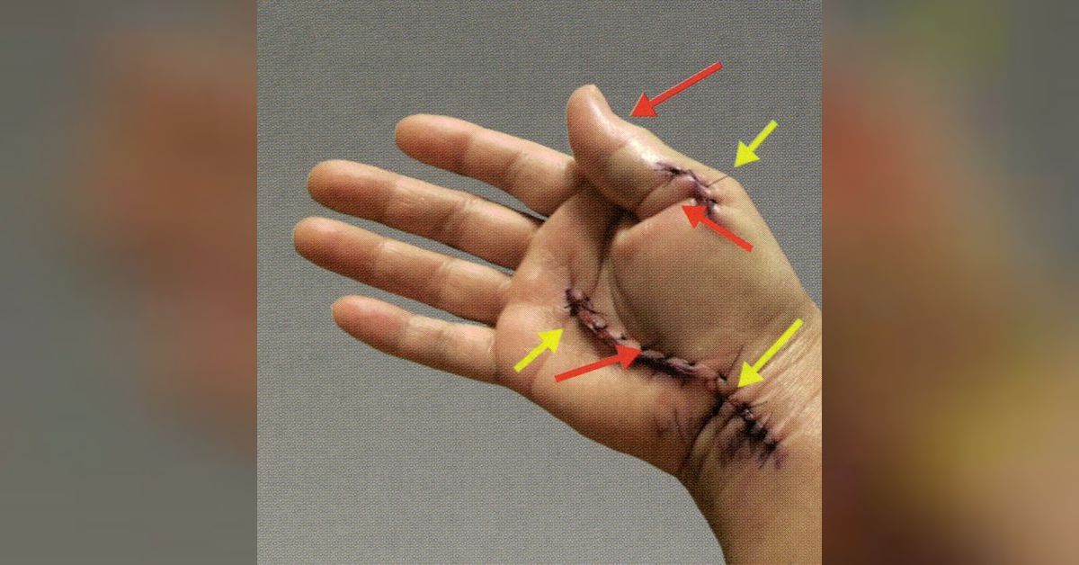 42: Scars and Scar Tissue (with Cathy Ryan) | The Thinking Practitioner