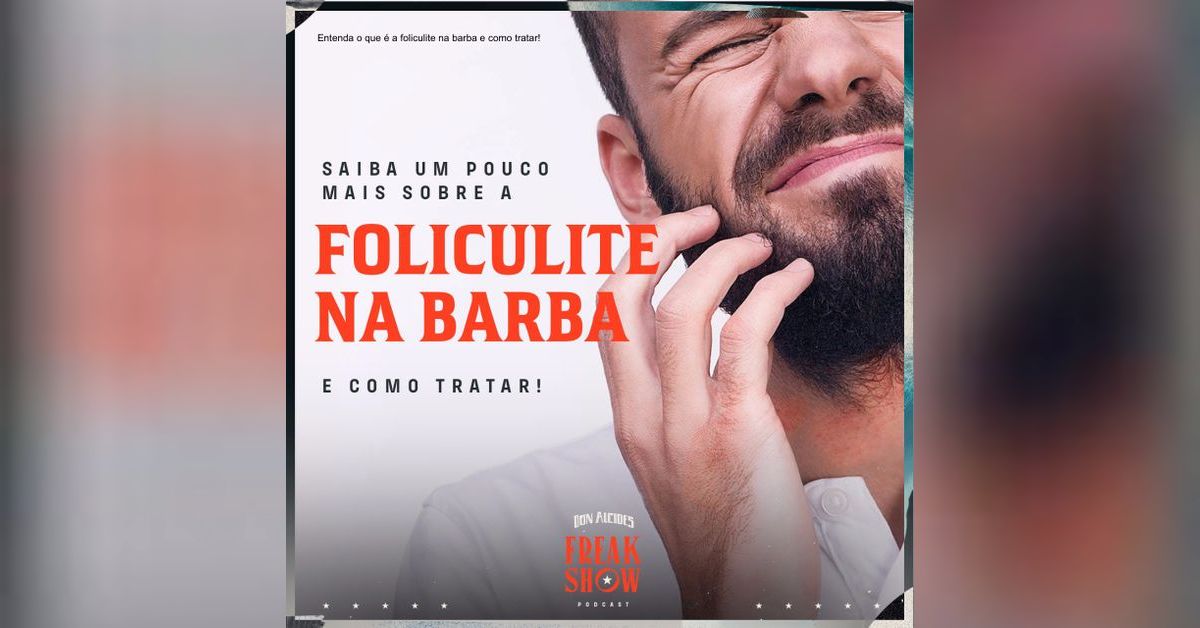 Entenda o que é a foliculite na barba e como tratar! | Don Alcides ...