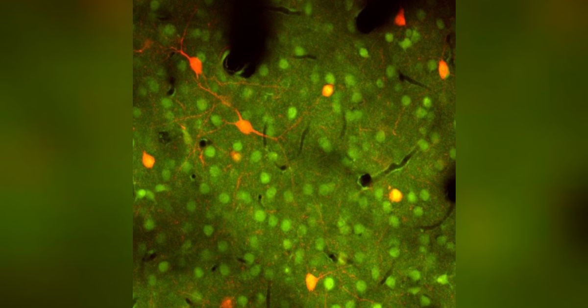 Manifestation of Acoustic Trauma in the Auditory Cortex | Journal of ...
