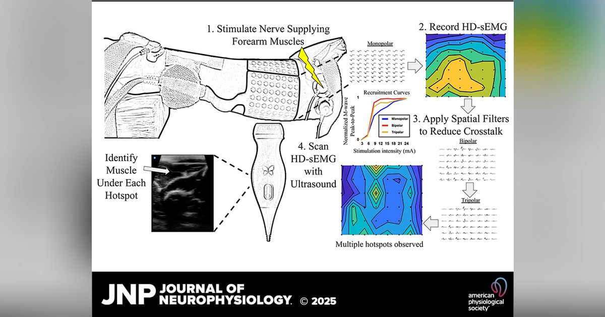 JNP Podcasts: Improving localization and measurements of M-waves using ...