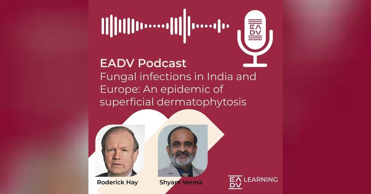 E78: Fungal infections in India and Europe: An epidemic of superficial dermatophytosis | EADV ...
