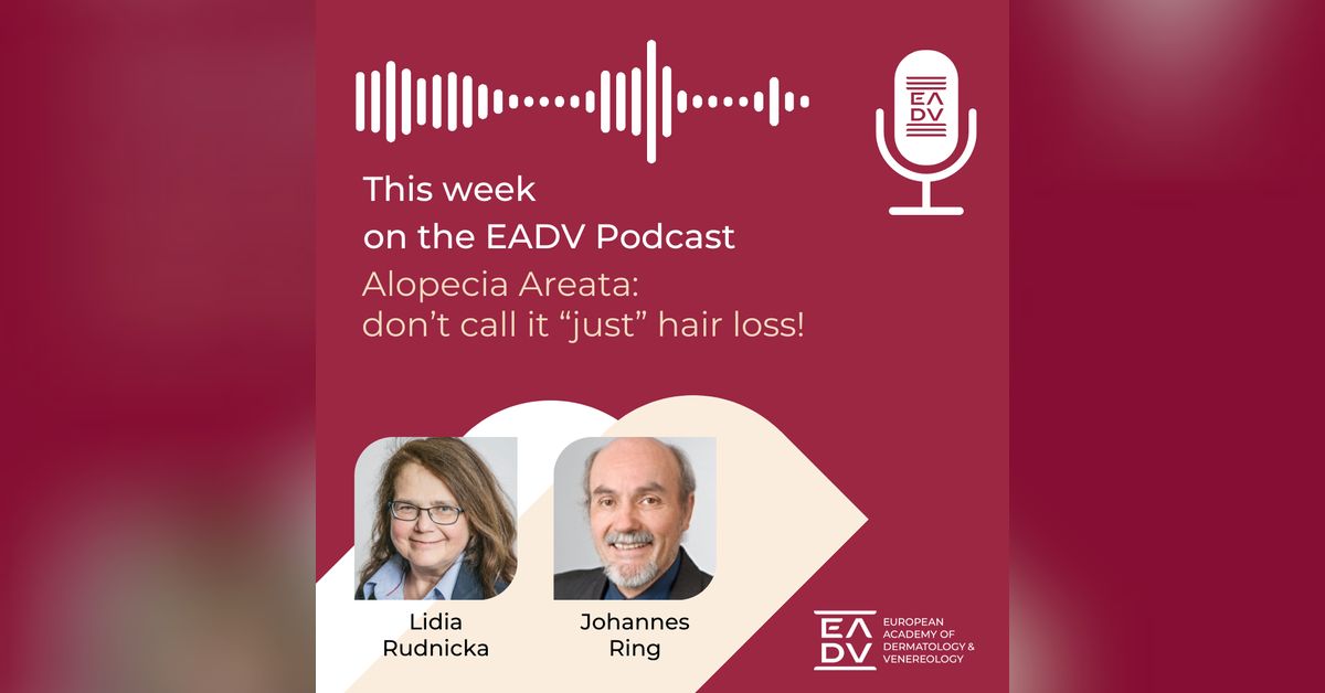 E124: Alopecia Areata: don’t call it “just” hair loss! | EADV Podcast